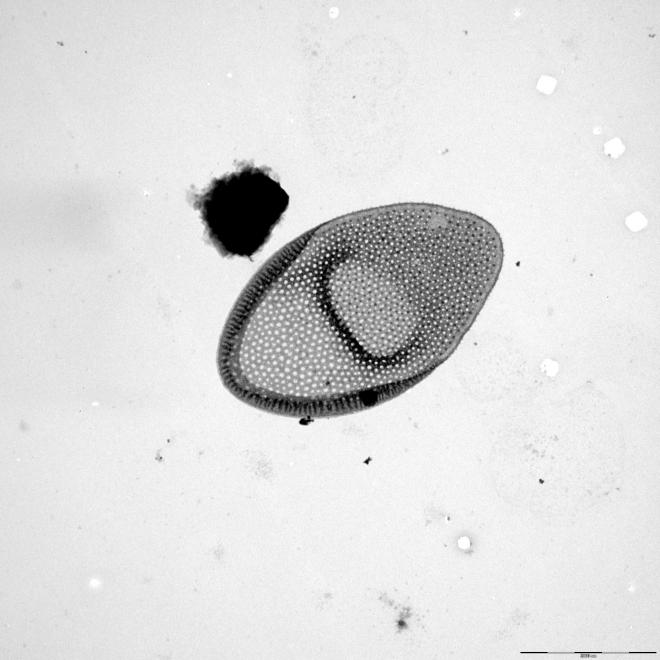 Mallomonas peronoides | Silica-scaled chrysophytes of Europe